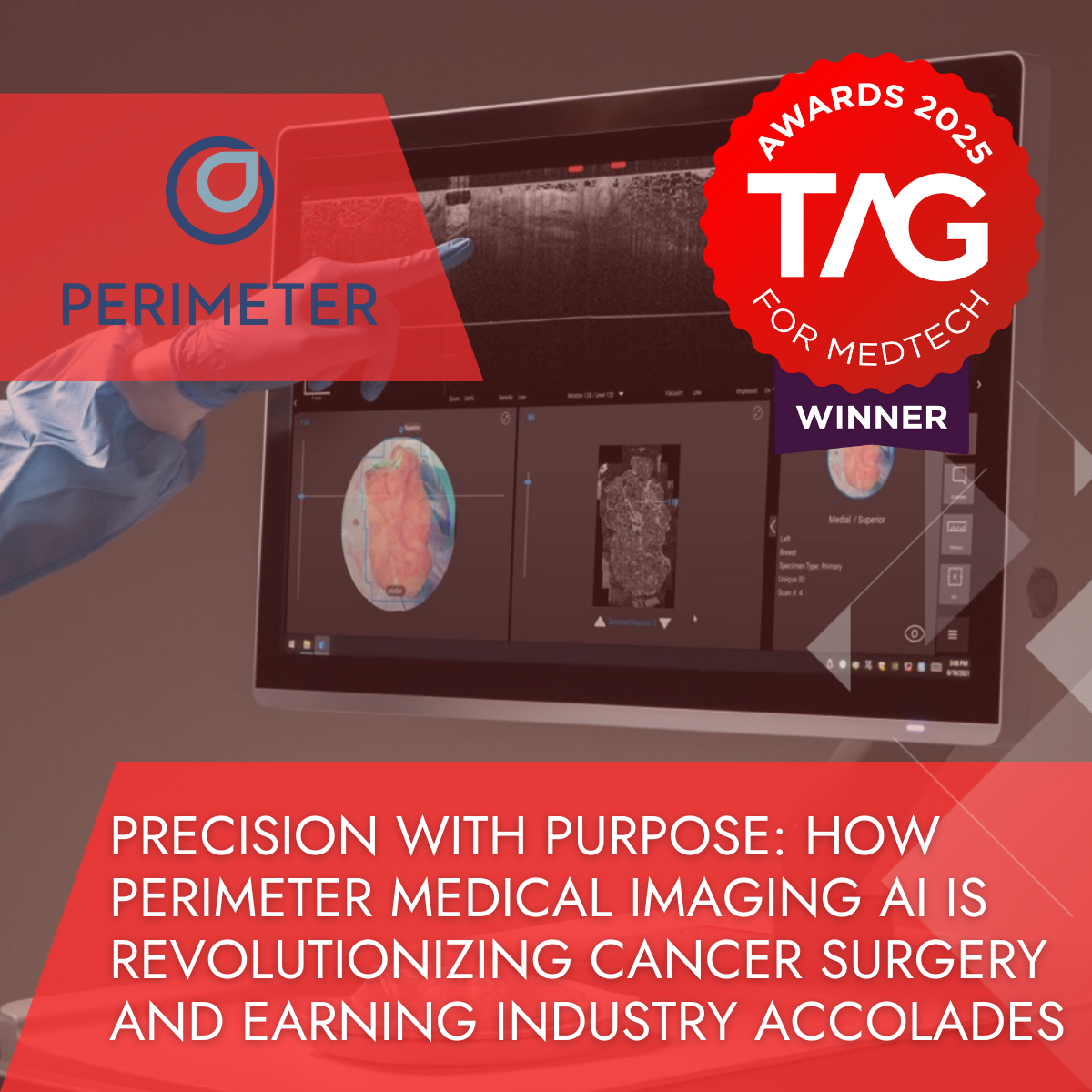 Celebrating Perimeter: An Award-Winning Approach to Clearer Margins ...